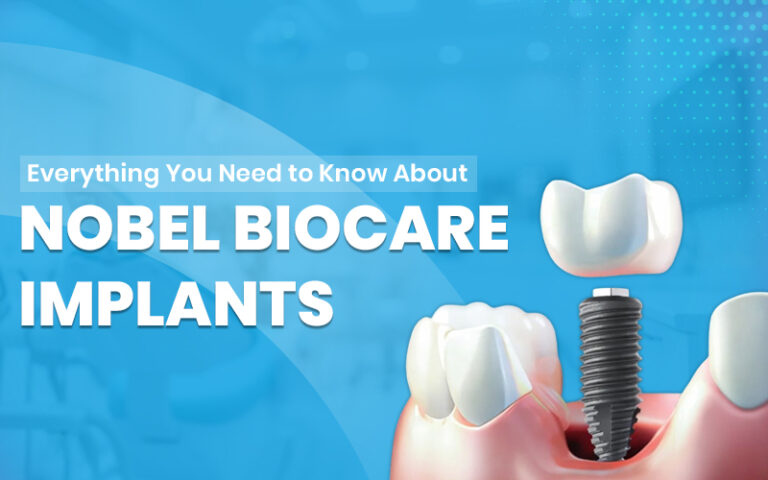 Everything You Need to Know About Nobel Biocare Implants